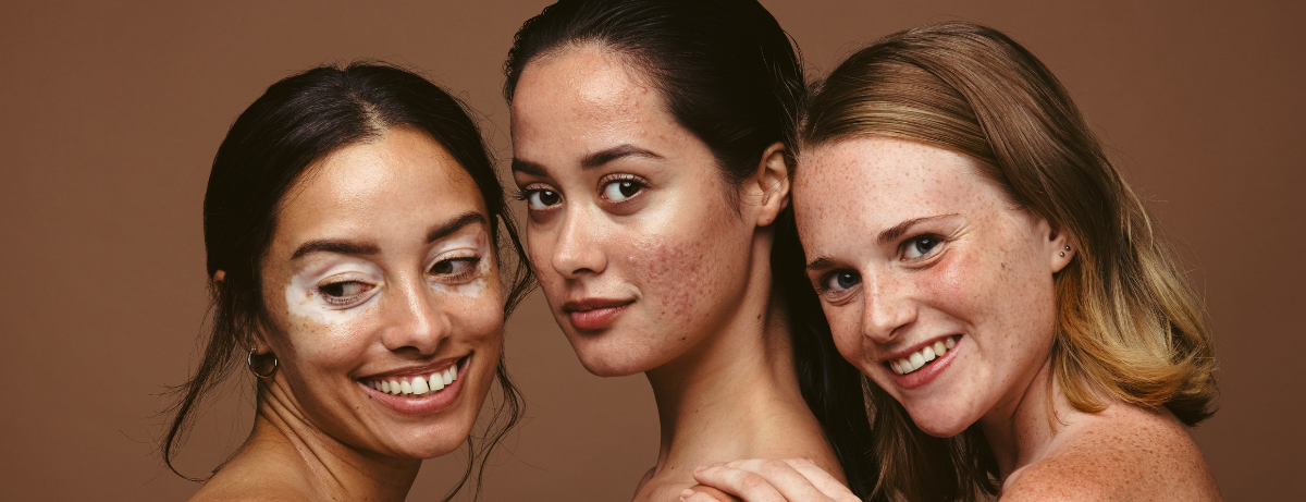 How to manage skin conditions | Hives, eczema & more | H&B