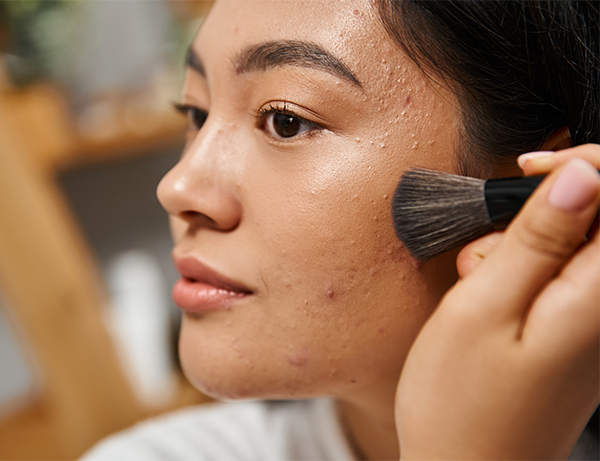 9 Ways To Manage Clogged Pores & Congested Skin | Holland & Barrett