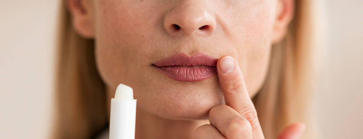 Chapped Lips: Causes & Remedies | Holland & Barrett