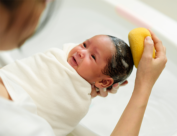 What is cradle cap? | Caring for cradle cap & treatment | H&B